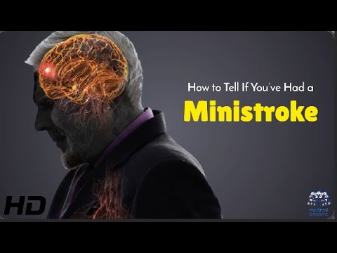 Ministroke Explained: Warning Signs You Should NEVER Ignore!