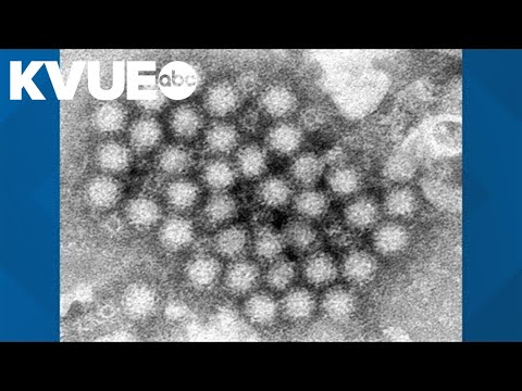 'Norovirus' spreads across the U.S., according to CDC