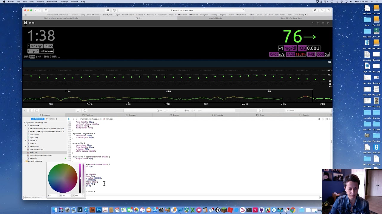GitHub and nightscout
