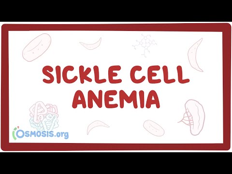 Sickle cell anemia - causes, symptoms, diagnosis, treatment & pathology