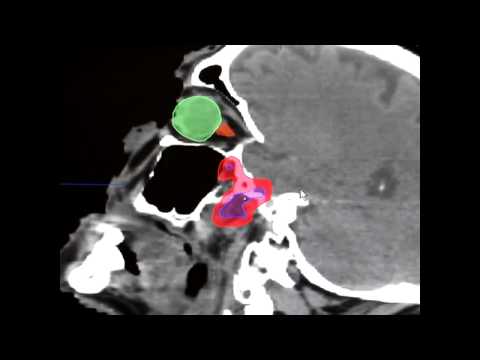 CT Scan