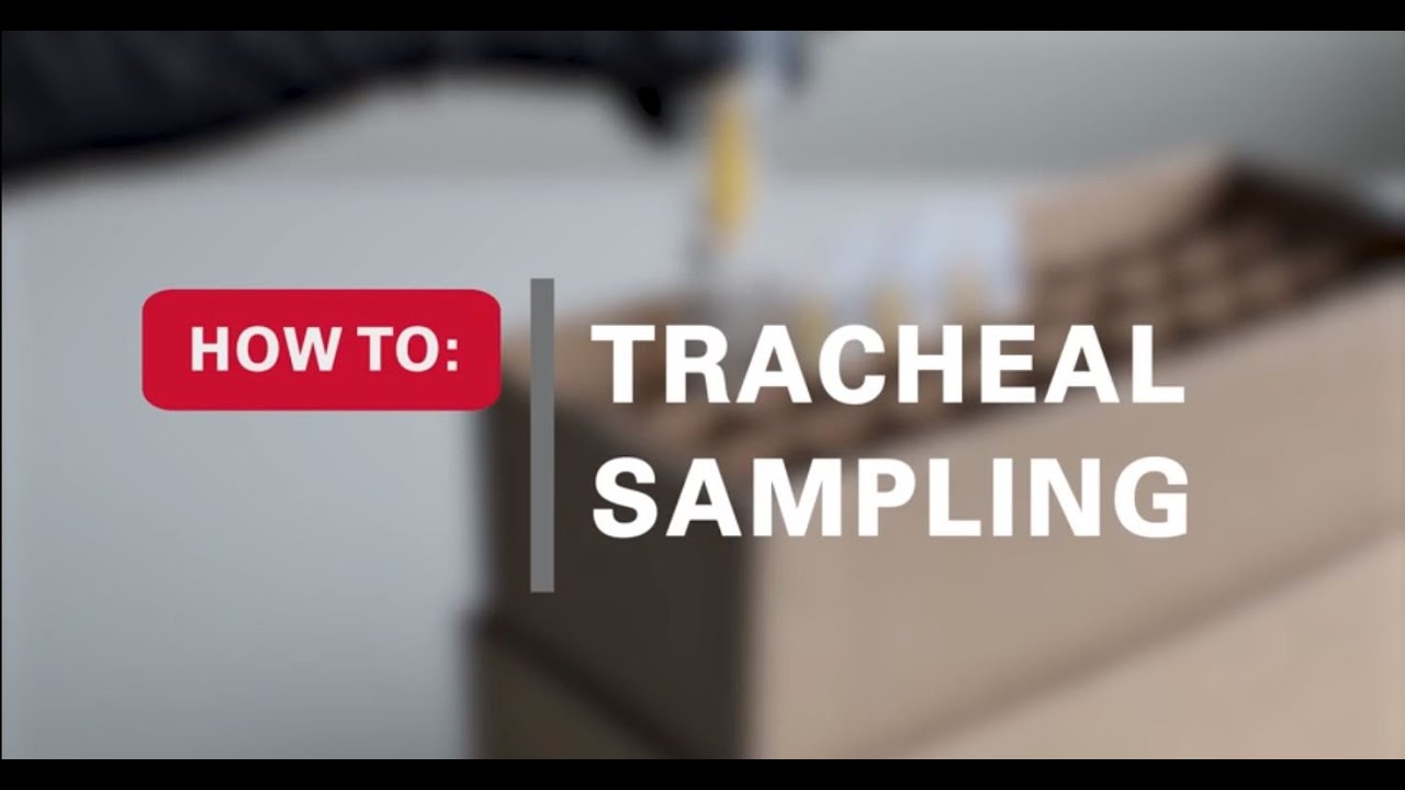 VDL-Tracheal Sampling - Feature Stories