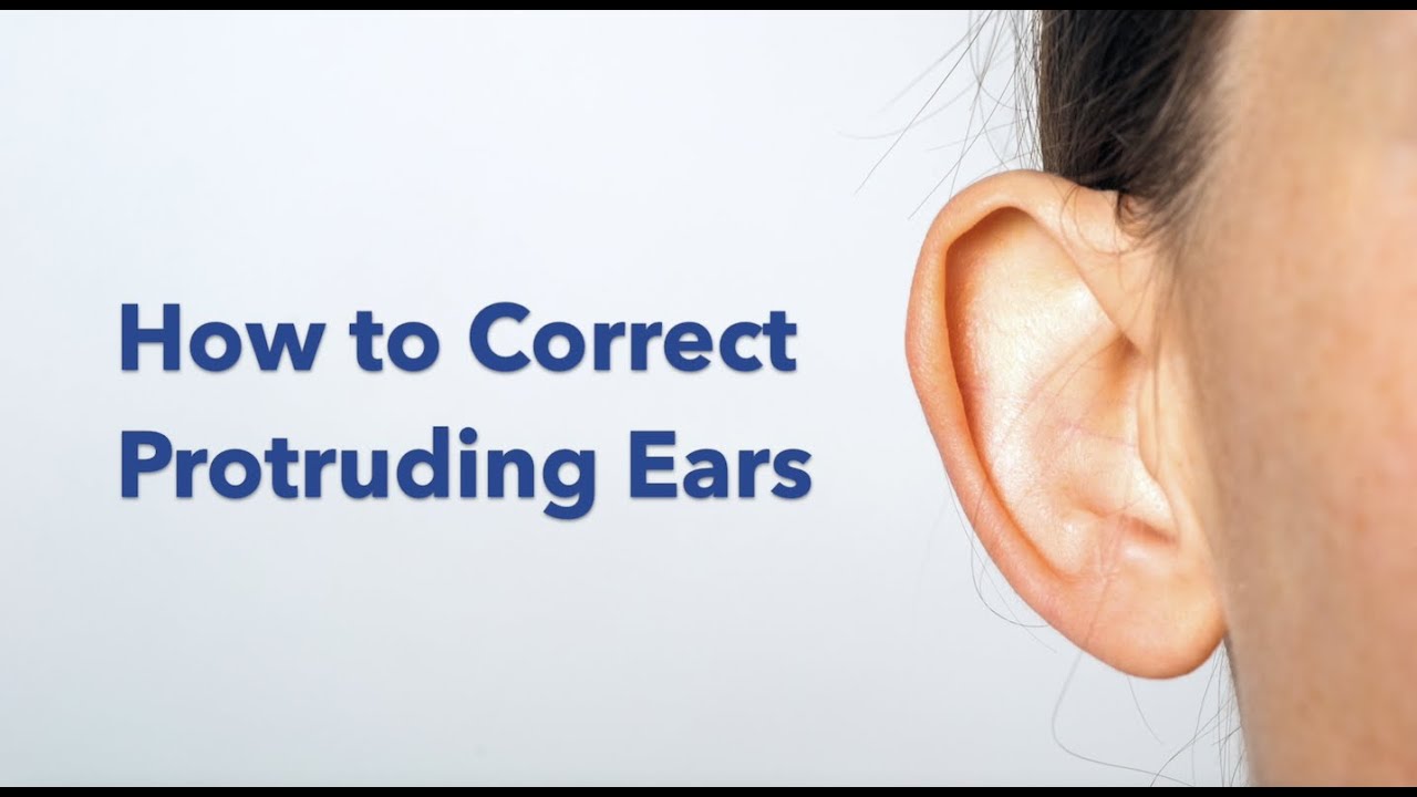 Otoplasty (ear pinning) surgery explained