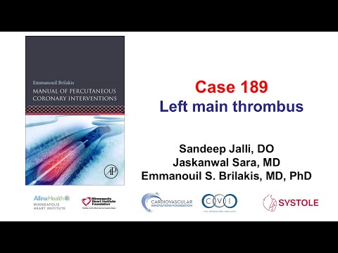 Case 189: Manual of PCI - Left main thrombus