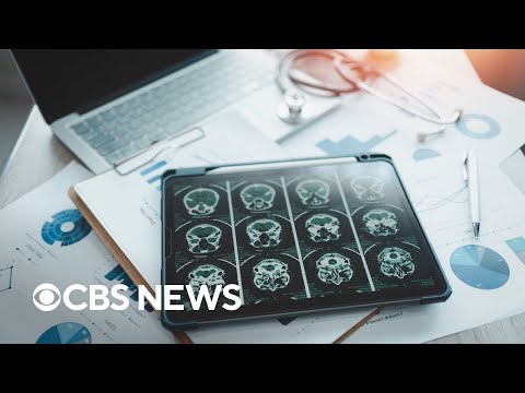How new Alzheimer's drug Leqembi works, risks and who might benefit
