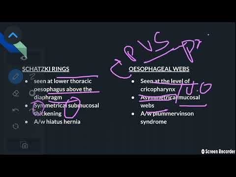 zenker diverticulum;schatzki ring; oesophageal webs, diffuse oesophageal spasm;nutcracker oesophagus