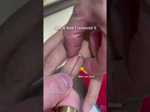 Ring STUCK on Finger? DO THIS‼️