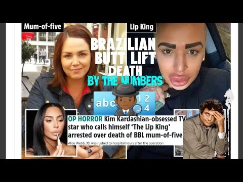 1/2 "BOTCHED" BBL 🇬🇧 1st UK Death: Alice Webb via "The Lip King" Jordan James Parke, Kim Kardashian