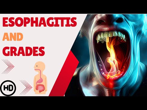 What is Esophagitis ⭕️ Grades and types !