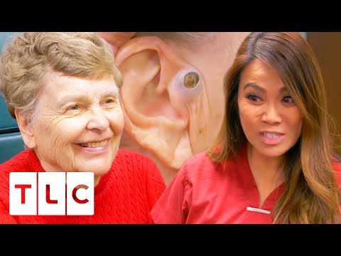 25 Grossest Pimple Popping Videos Of All Time - Zit Popping 2021