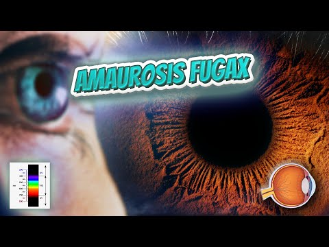Amaurosis fugax - Your EYEBALLS - EYNTK 👁️💉😳💊🔊💯✅