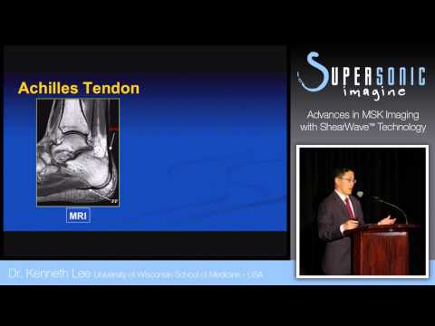RSNA 2013 - Advances in MSK Imaging with ShearWave™ Elastography by Dr. Kenneth Lee