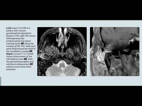 Head and neck radiology diagnostic imaging series images only(1)