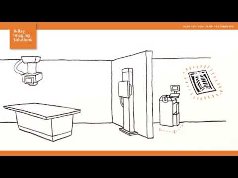 Carestream CR System - Latest Price, Dealers & Retailers in India