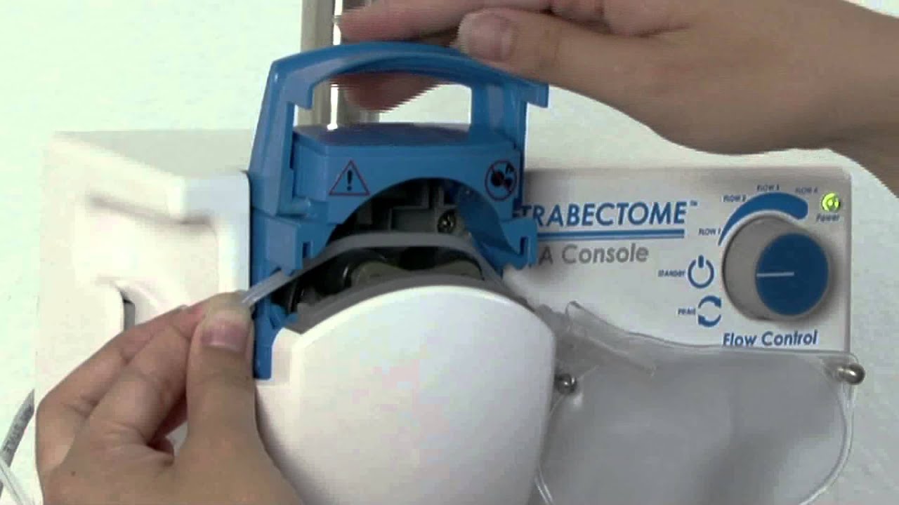 Trabectome Equipment Set-Up (4:27 min)