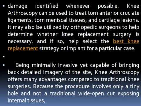 Insights on Knee Surgery: Why Choose the Laparoscopic Technique ...