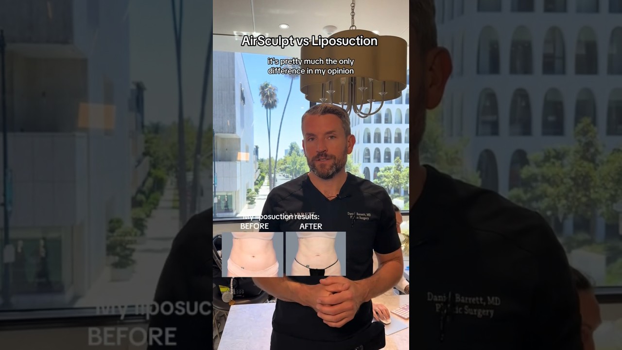 Avoid This Liposuction Alternative! 🫣