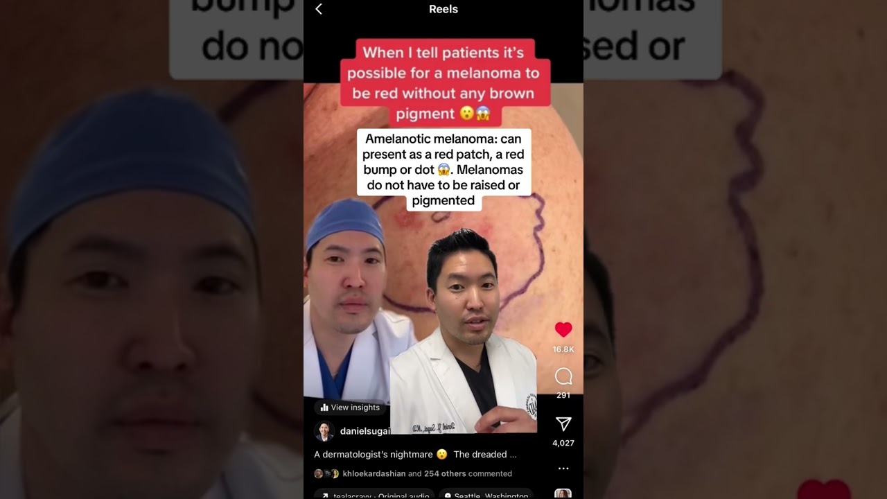 Dermatologist Explains: Amelanotic Melanoma Awareness