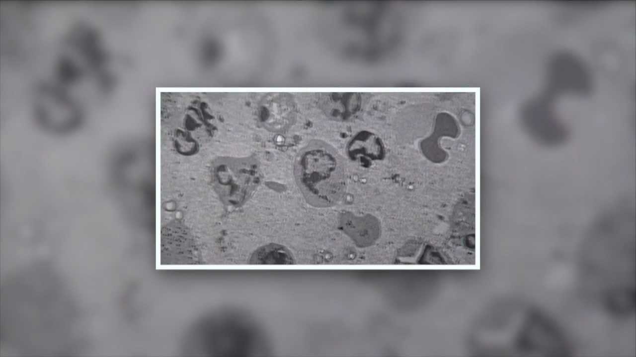 Electron Microscope MRSA in mouse bone