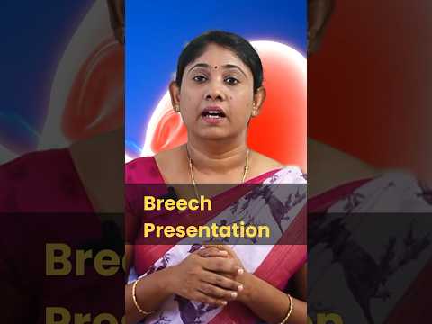 Breech presentation #pregnancytips #normaldelivery #baby #drsavitha #udumalpet