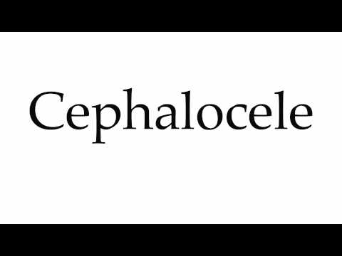 How to Pronounce Cephalocele