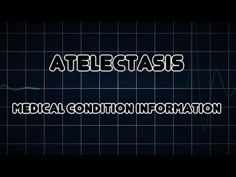 Atelectasis (Medical Condition)