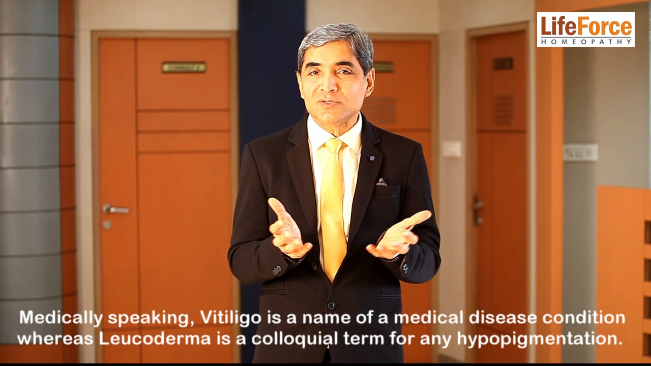 What is the difference between Vitiligo and Leucoderma?