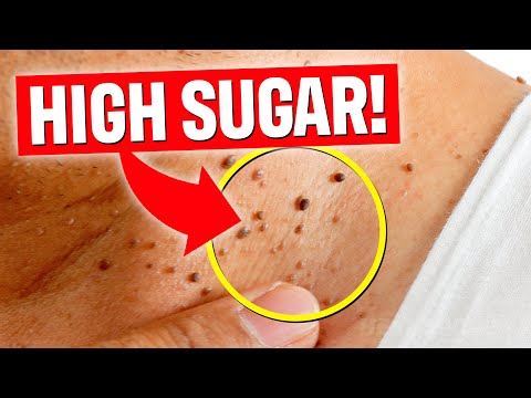 Your SKIN Is Warning YOU About Your Health! - (7 Signs To Lookout For)