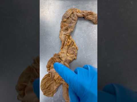 The Function of Your Colon