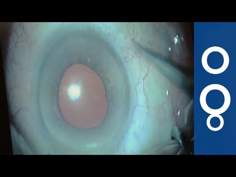 New Adaptable Lens Prolong Sight Of Aging Eyes - Futuris