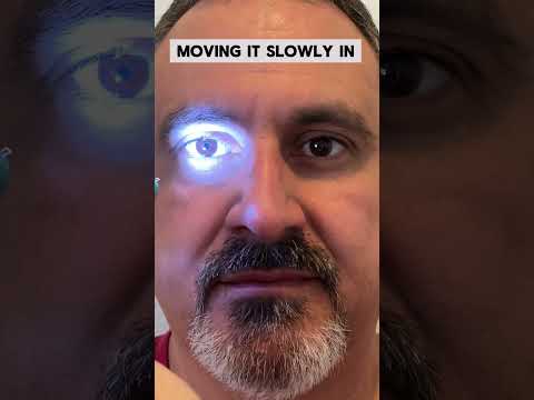 Neuro Assessment PERRLA