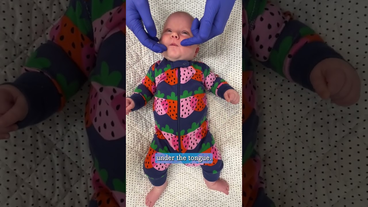 Infant Tongue Tie Stretches Demo