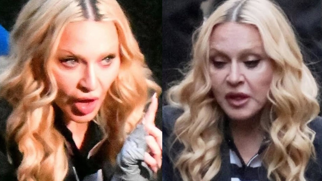 Fans Say Madonna Went Too Far… What Happened to Her Face?