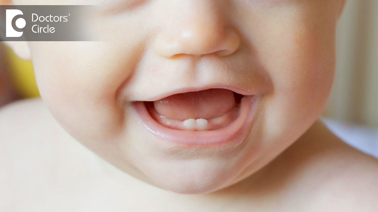 How important are milk teeth? - Dr. Srivats Bharadwaj