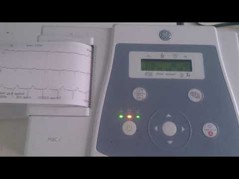 GE ECG Machine - Latest Price, Dealers & Retailers in India