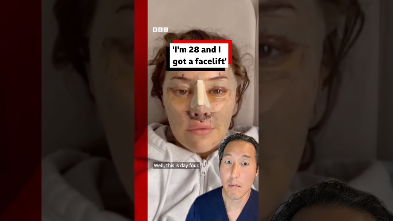 Should Plastic Surgeons Perform Facelifts on 28 Year Olds?