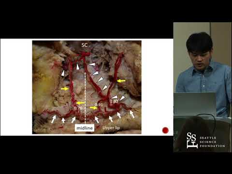 An Oblique Columellar Artery Variant - Paul J. Choi, MD