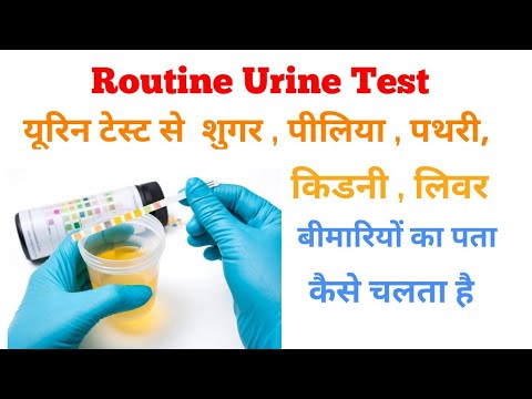 urine routine test explain in Hindi | urine test normal range