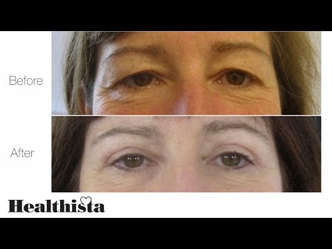 The 30-Minute Mini Eye Lift Treatment