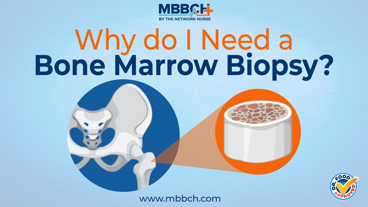 Why do I Need a Bone Marrow Biopsy? I MBBCH