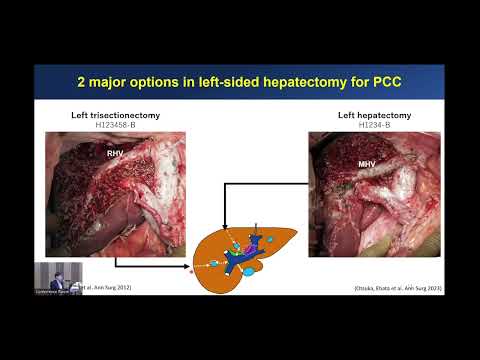 Resectability and Choice of Procedure in Perihilar Cholangiocarcinoma