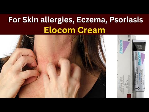 Elocom Cream uses | best cream for atopic dermatitis | mometasone furoate cream| skin allergy