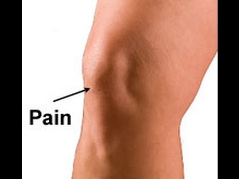 Steam Community :: Video :: The Kneecapper (Fallout 4)