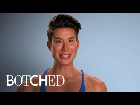 Human Ken Doll Is BACK With MORE Implants | Botched | E!
