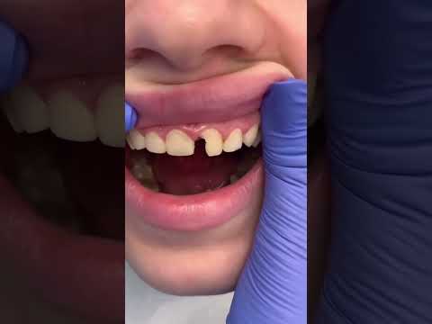 Your Teeth Are Not Tools TikTok @drmassidental
