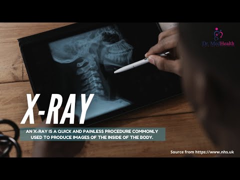 X-ray | How X-rays work | When X-rays are used | Are X-rays safe?