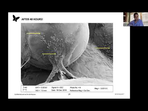 Ti Life Technology Biometic Titanium - Joseph Laratta, M.D.