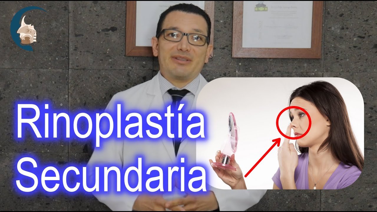 Rinoplastia Secundaria | PlasticFacial MX