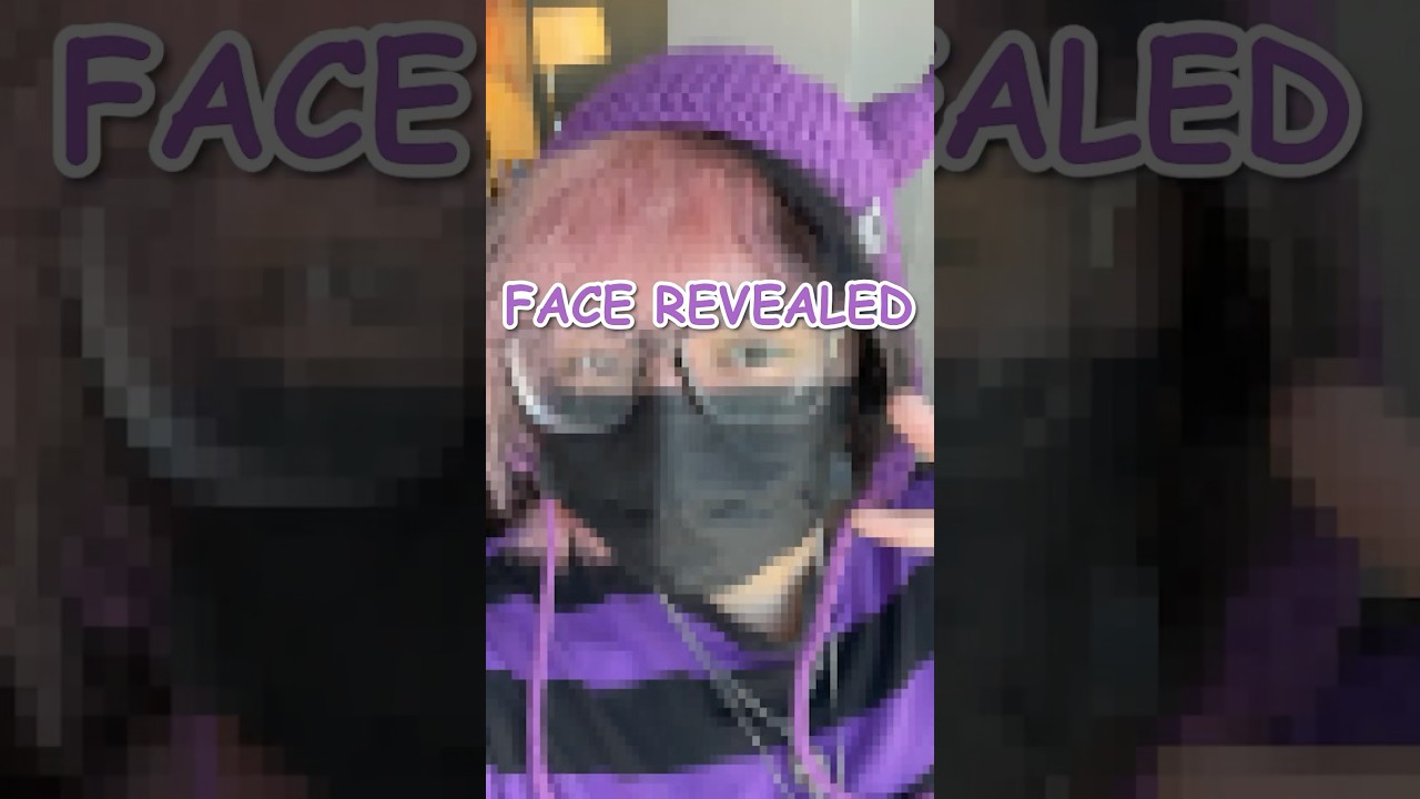 I FACE REVEALED ON ACCIDENT…