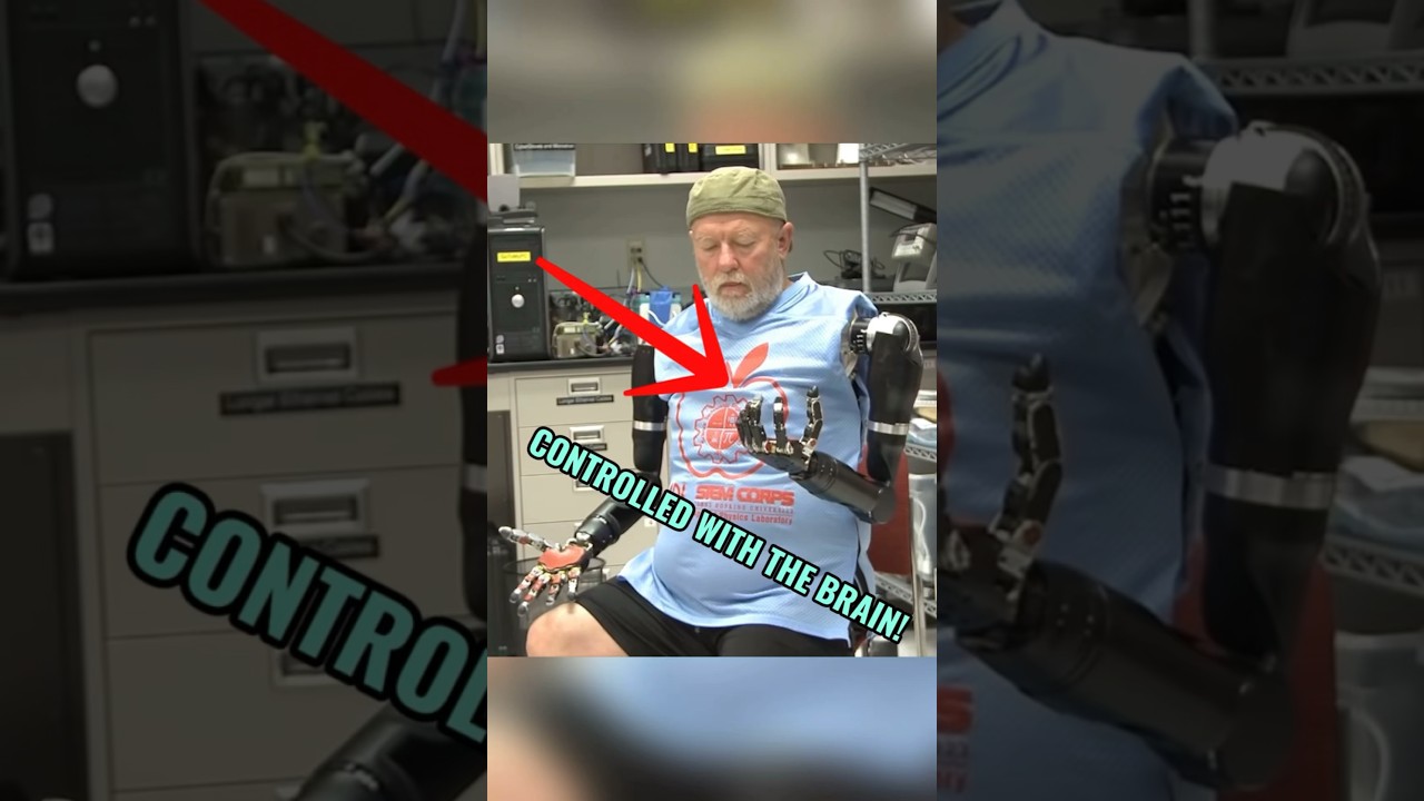 The Prosthetic That’s Controlled With the Brain🧠